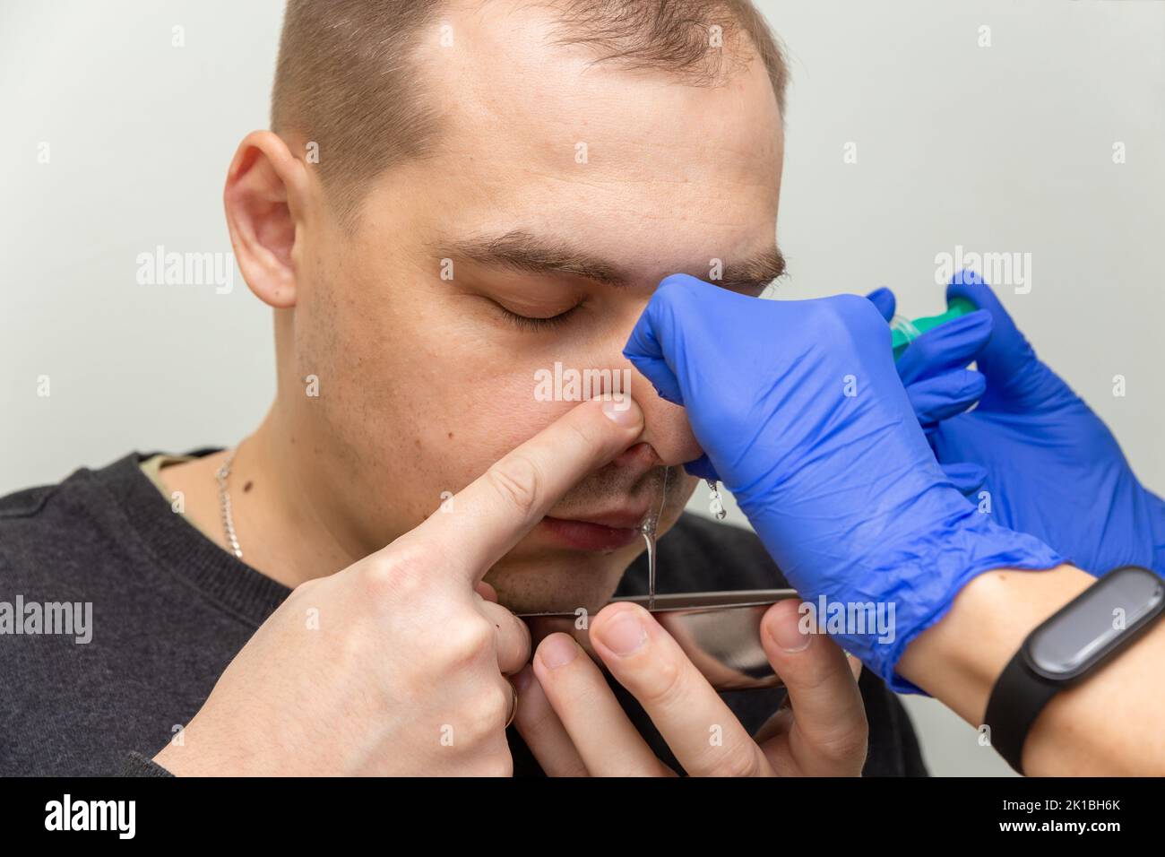 A nurse rinses the nasal cavity of a patient suffering from sinusitis ...