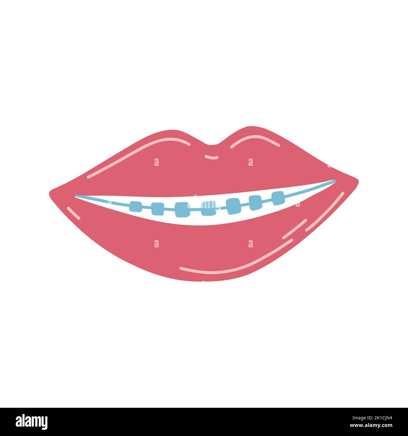 Hand drawn lips with teeth and braces in cartoon flat style. Vector ...