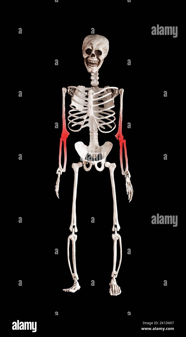 Mirrored Joint Pain at Harry Brawner blog