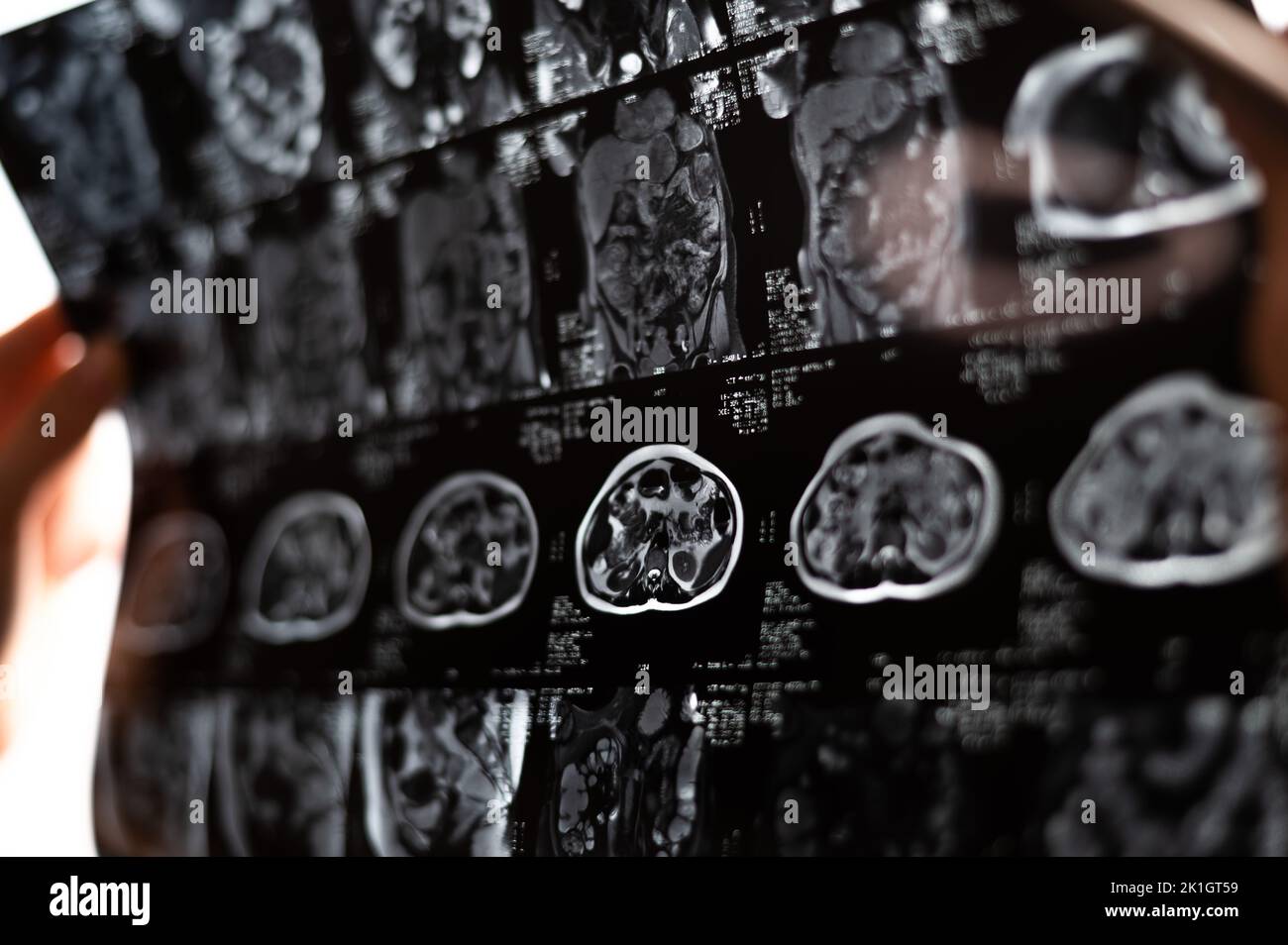 A female doctor examines an MRI scan of the internal organs. Abdomen ...