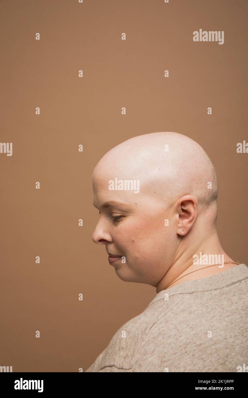 Bald head profile hi-res stock photography and images - Alamy