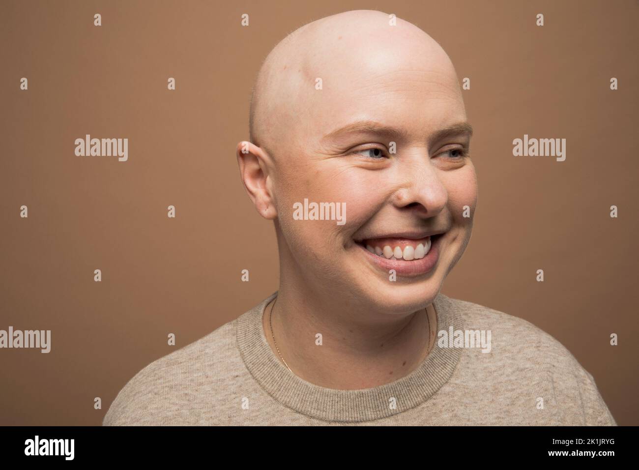 Alopecia bald head hi-res stock photography and images - Alamy
