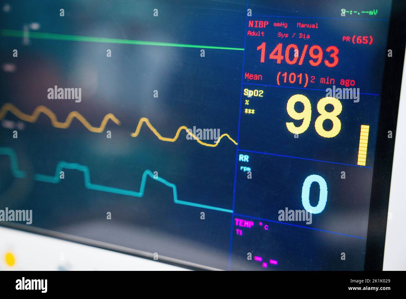 Electrocardiogram machine hi-res stock photography and images - Alamy