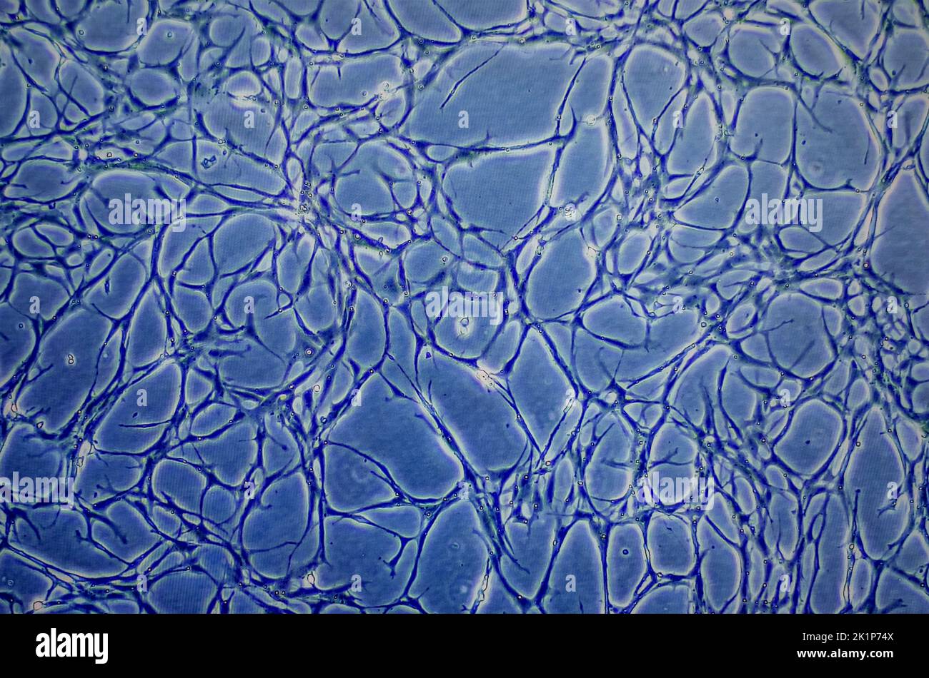 PRODUCTION - 09 September 2022, Schleswig-Holstein, Lübeck: Samples of ...