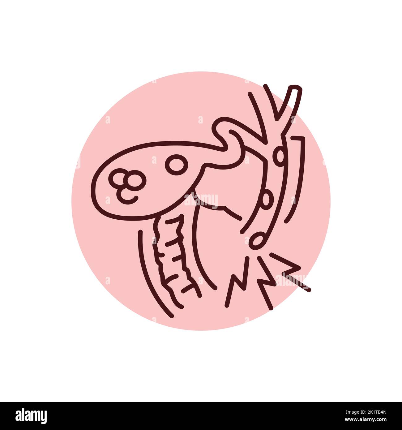 Chronic cholecystitis color line icon. Human diseases. Pictogram for ...