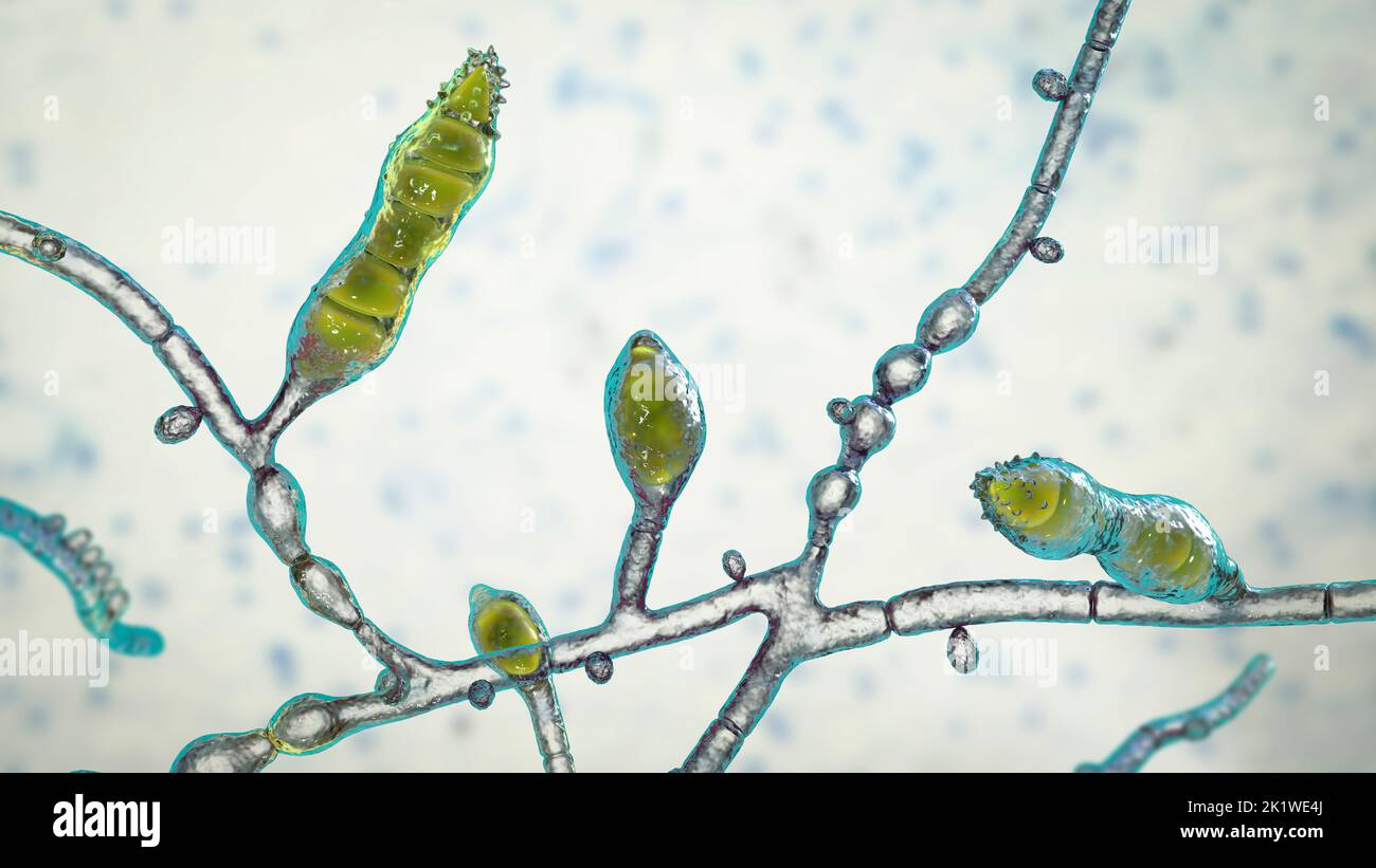 Microsporum audouinii fungus, illustration Stock Photo - Alamy