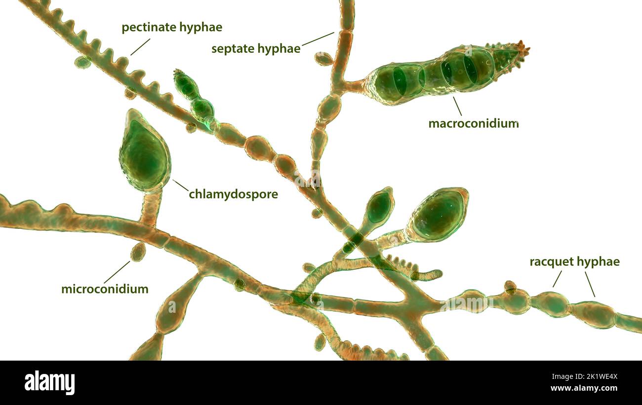 Microsporum audouinii fungus, illustration Stock Photo - Alamy