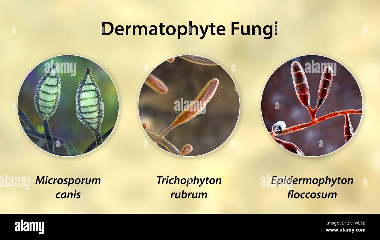 Dermatophyte fungi, illustration Stock Photo - Alamy