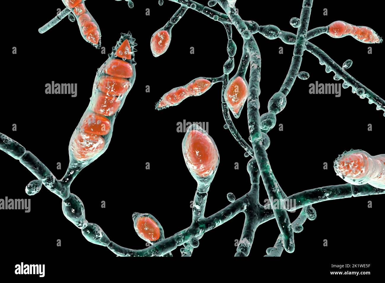Microsporum audouinii fungus, illustration Stock Photo - Alamy