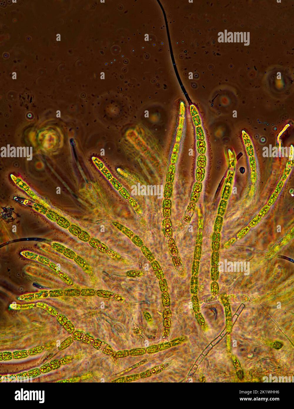 Algae, light micrograph Stock Photo - Alamy