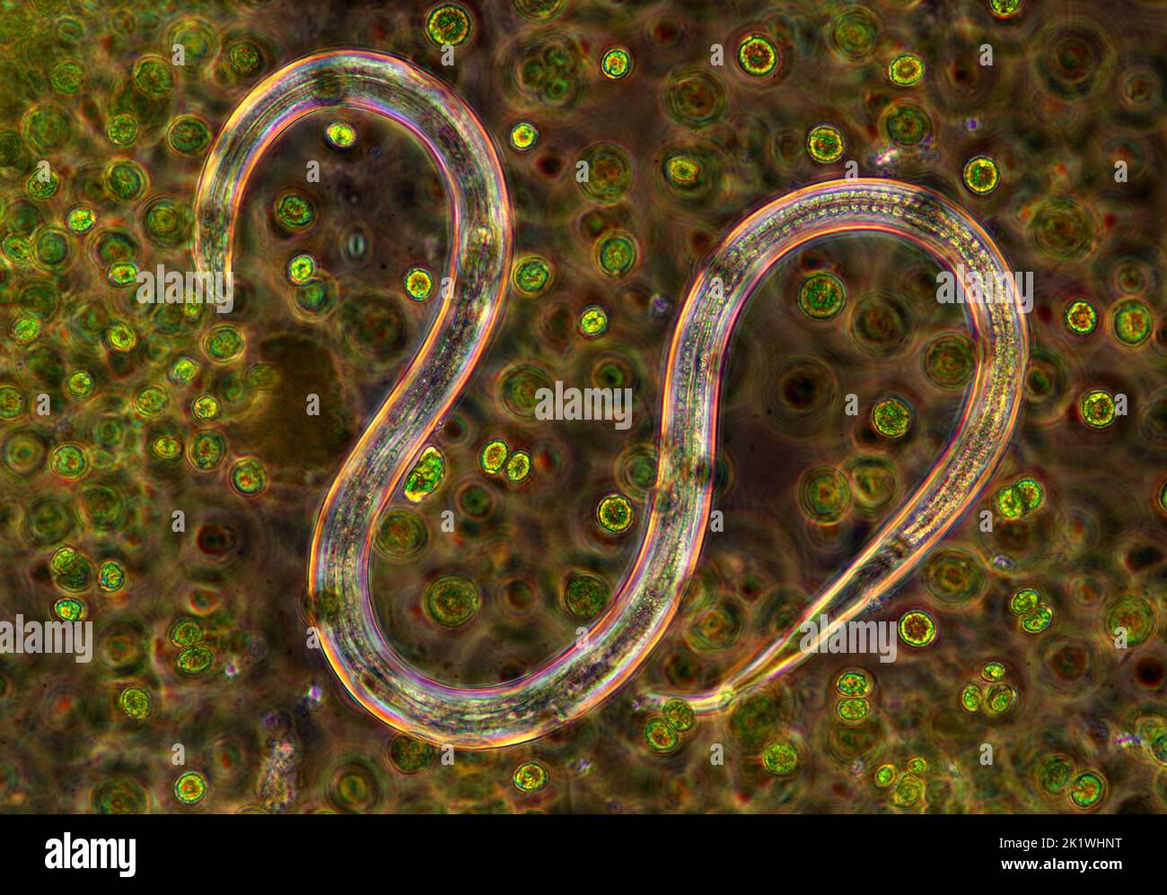 Nematode among green algae, light micrograph Stock Photo - Alamy