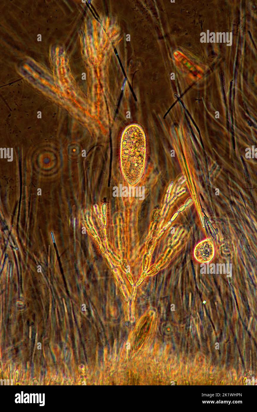 Ciliate and Batrachospermum red algae, light micrograph Stock Photo - Alamy