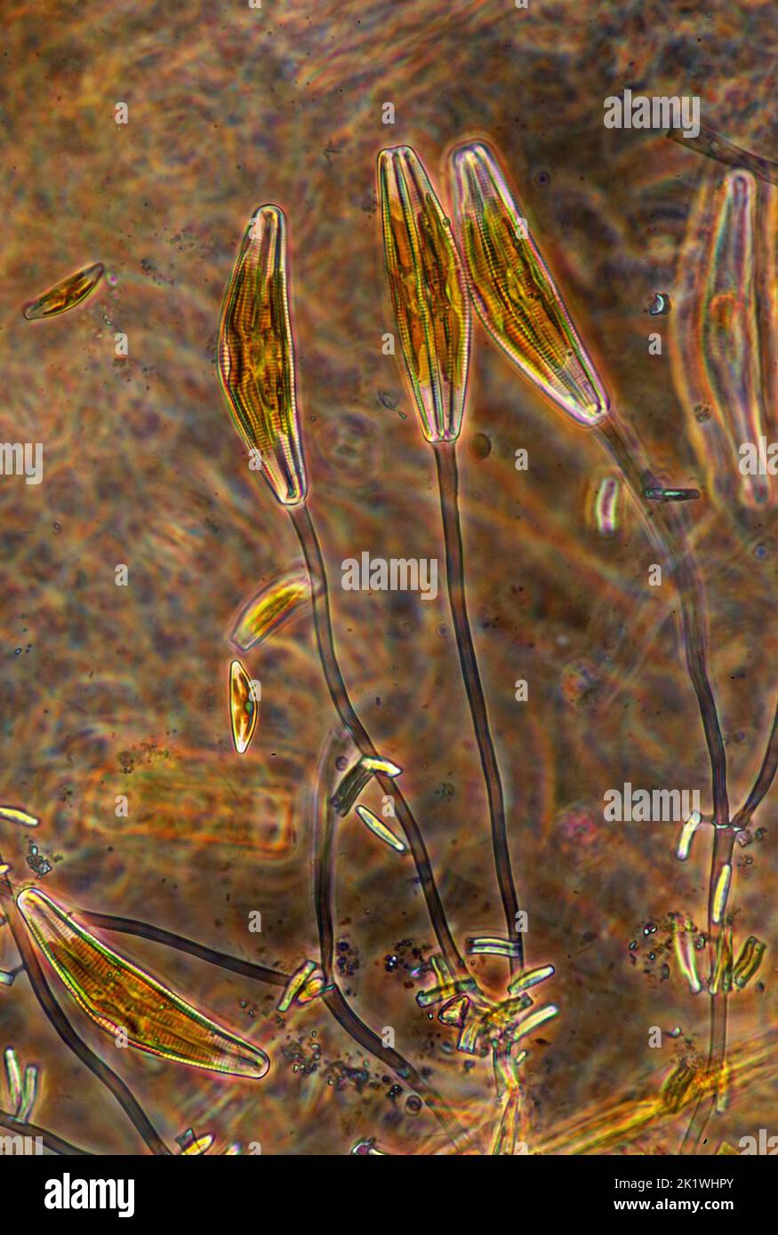 Cymbella sp. diatoms, light micrograph Stock Photo - Alamy