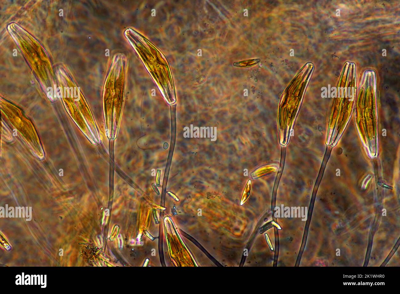 Cymbella sp. diatoms, light micrograph Stock Photo - Alamy