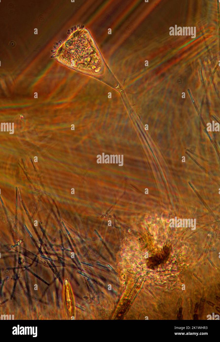 Suctorian ciliate, light micrograph Stock Photo - Alamy