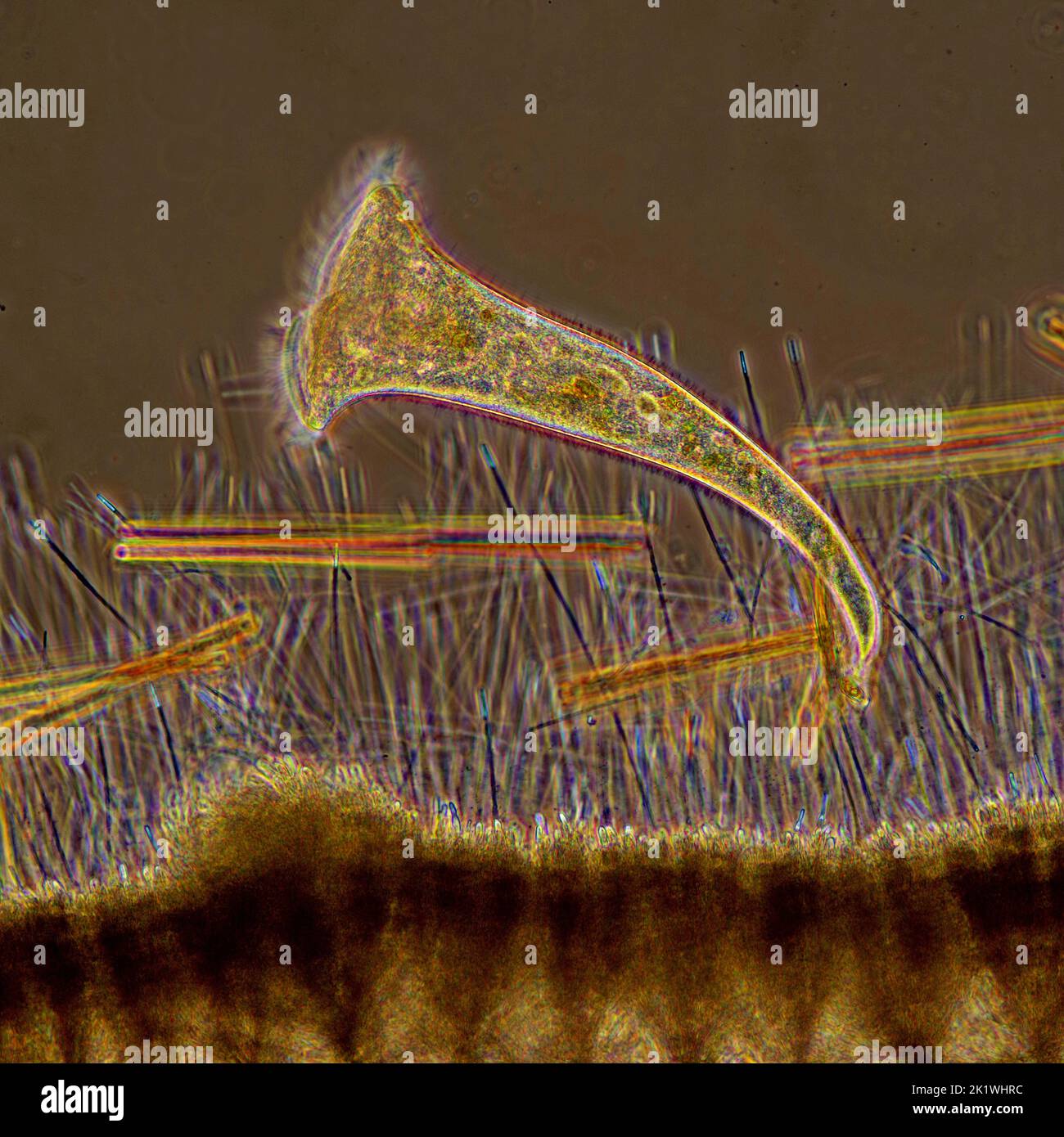 Stentor sp. ciliate and red algae, light micrograph Stock Photo - Alamy