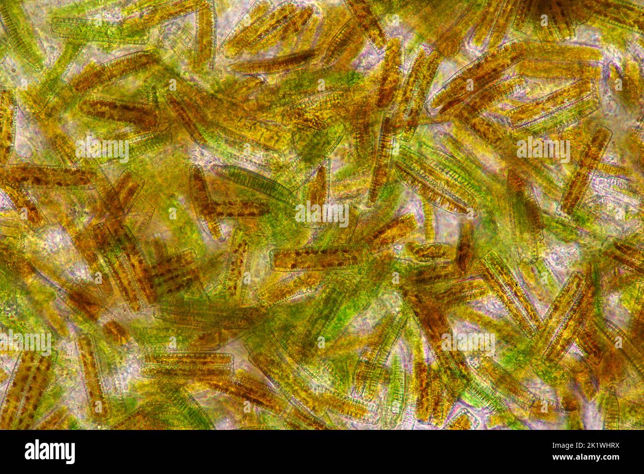 Epithemia diatoms, light micrograph Stock Photo - Alamy