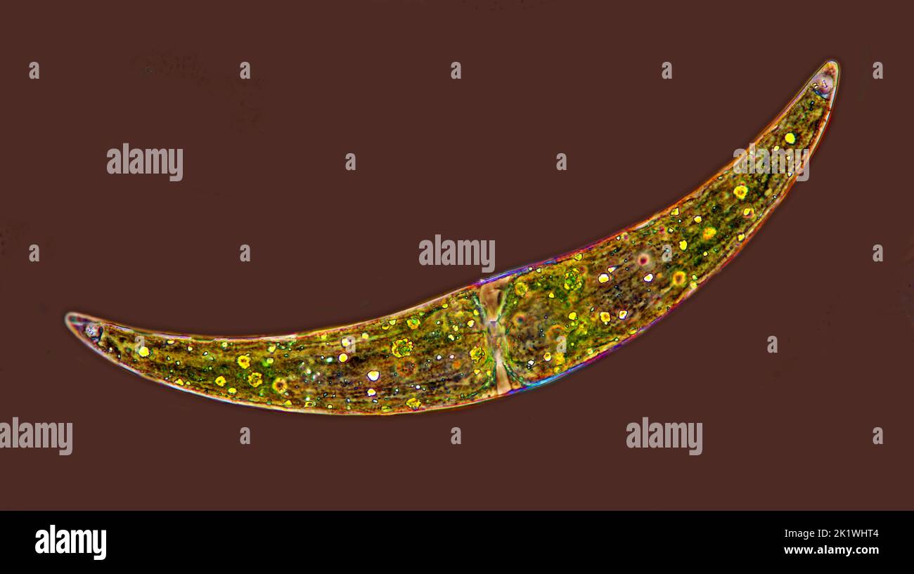 Closterium sp. desmid, light micrograph Stock Photo - Alamy