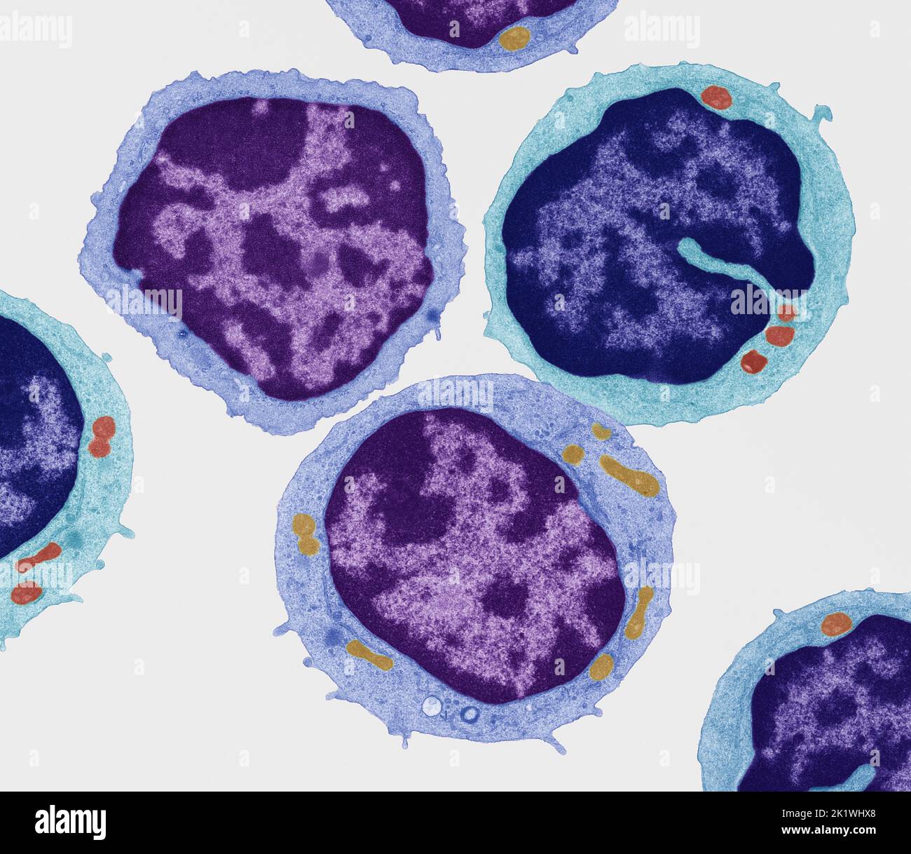 Small lymphocytes, TEM Stock Photo - Alamy