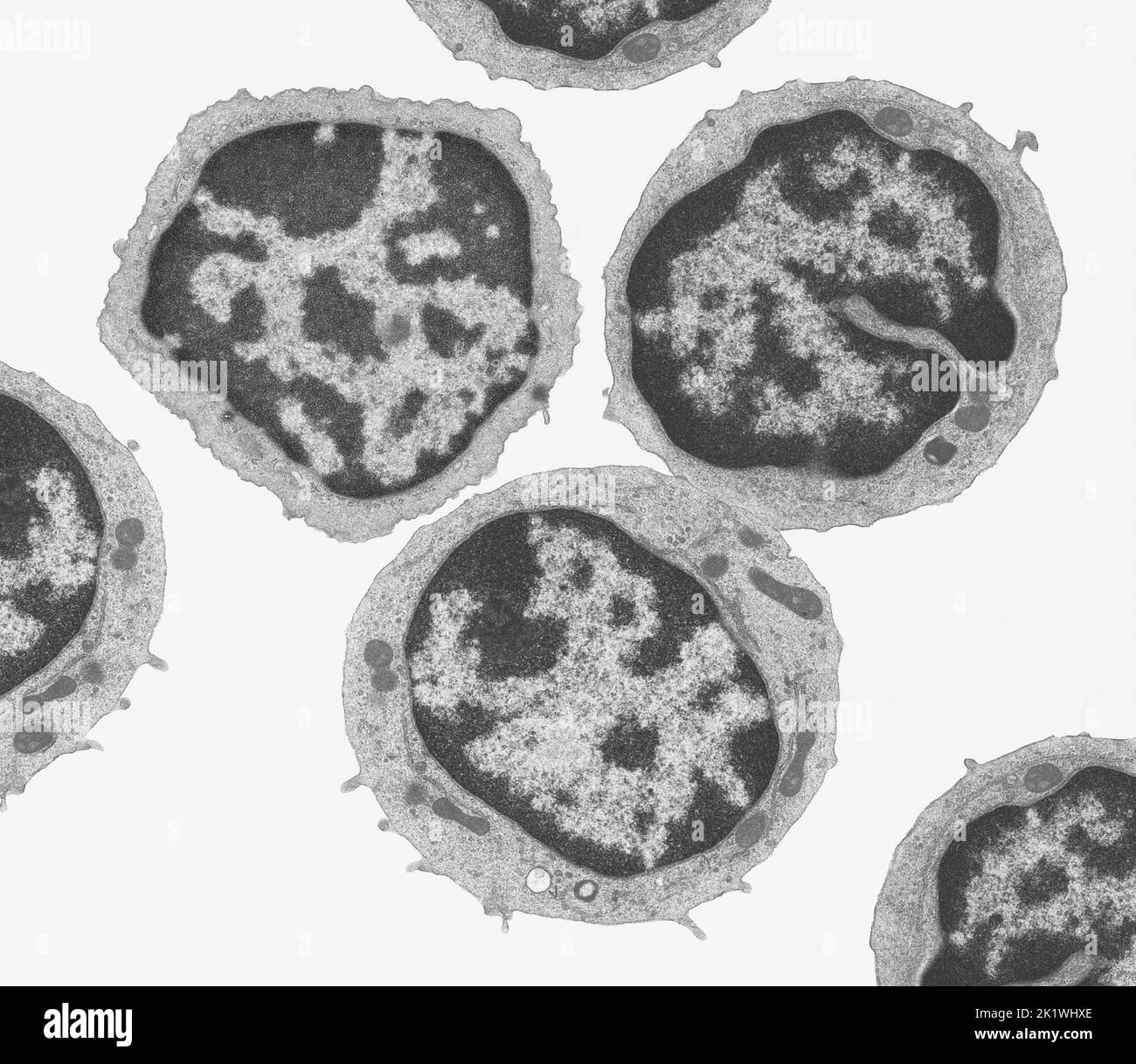 Small lymphocytes, TEM Stock Photo - Alamy