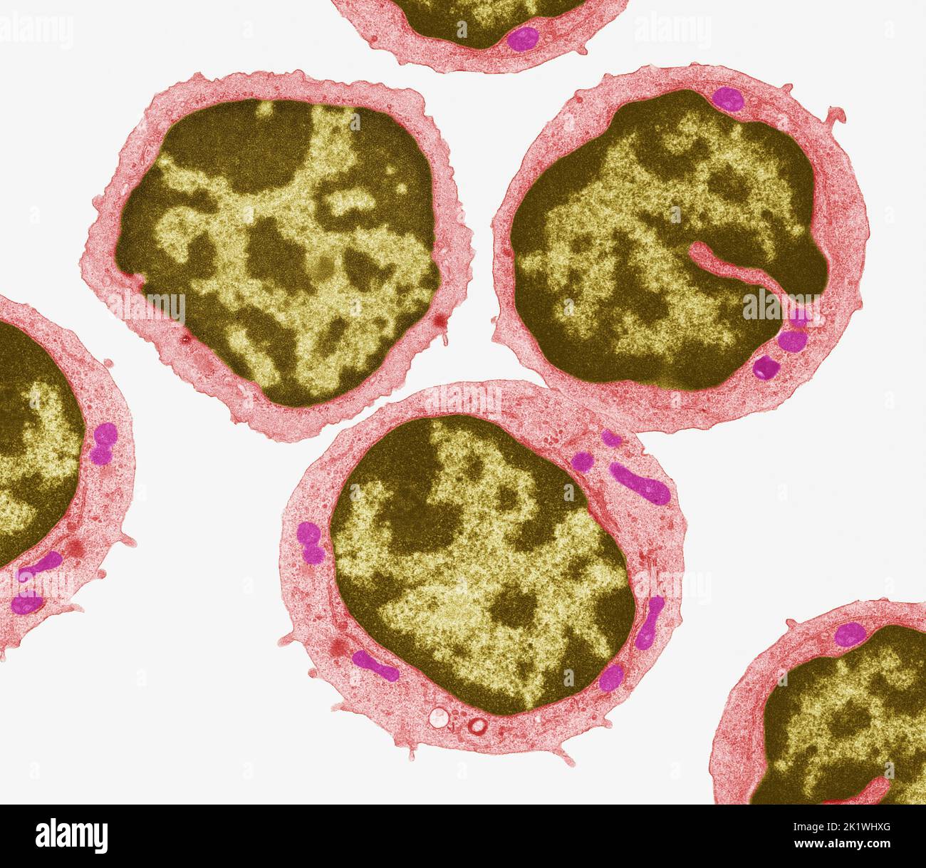 Small lymphocytes, TEM Stock Photo - Alamy