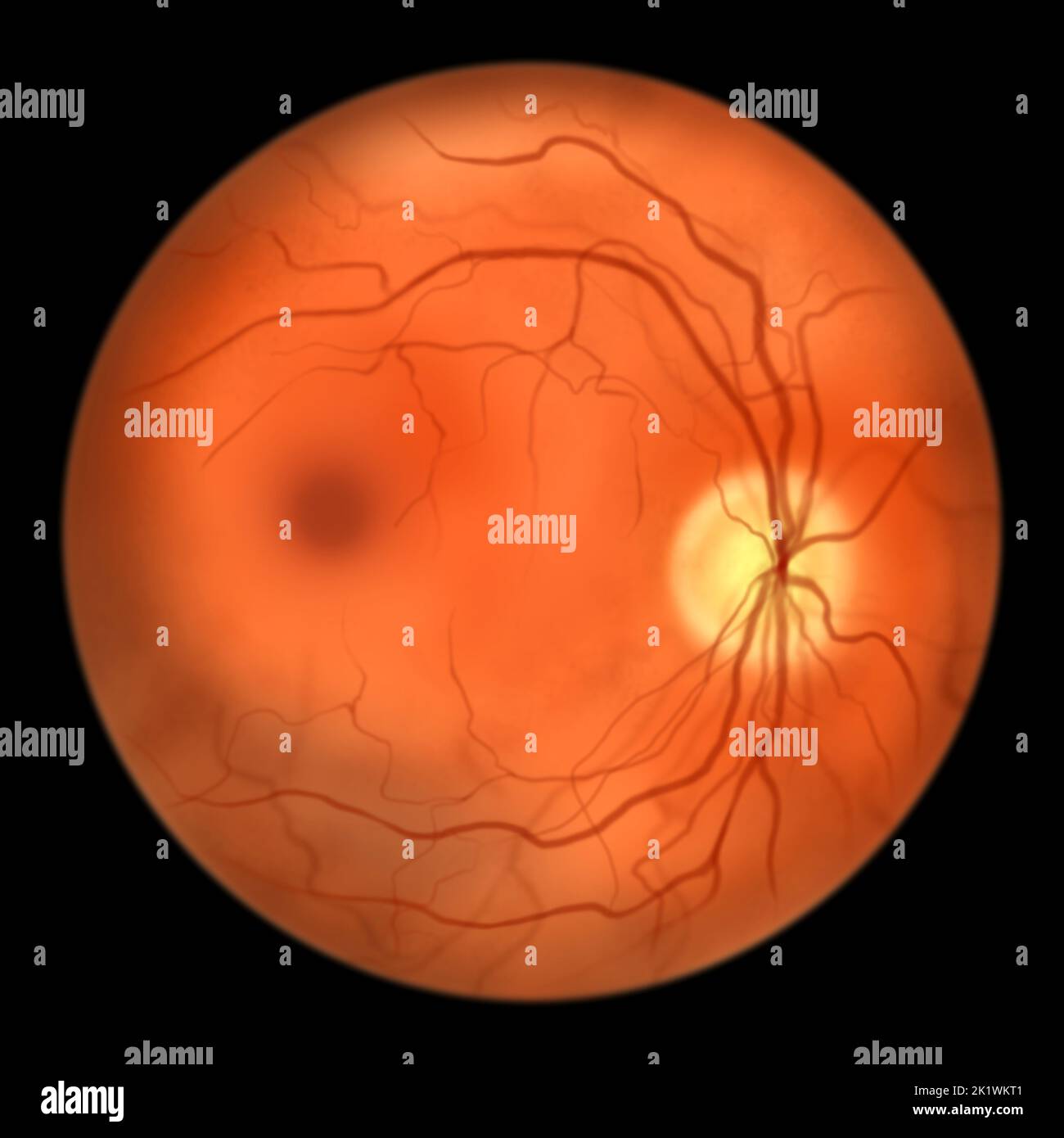 Normal retina hi-res stock photography and images - Alamy