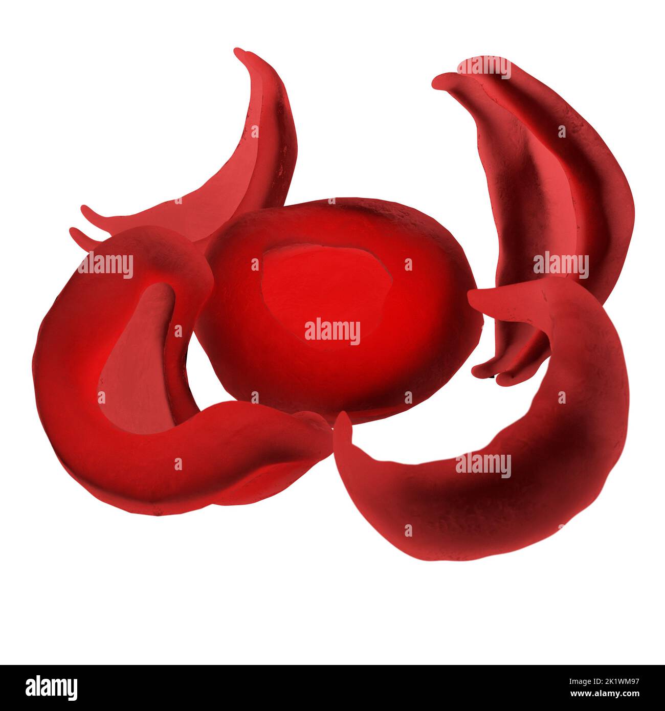 Sickle cell disease, illustration Stock Photo - Alamy