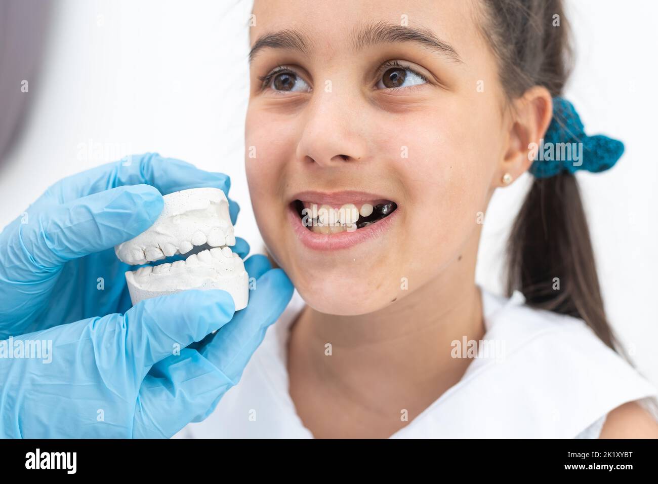 little girl with plaster cast of teeth and with the metal apparatus on ...
