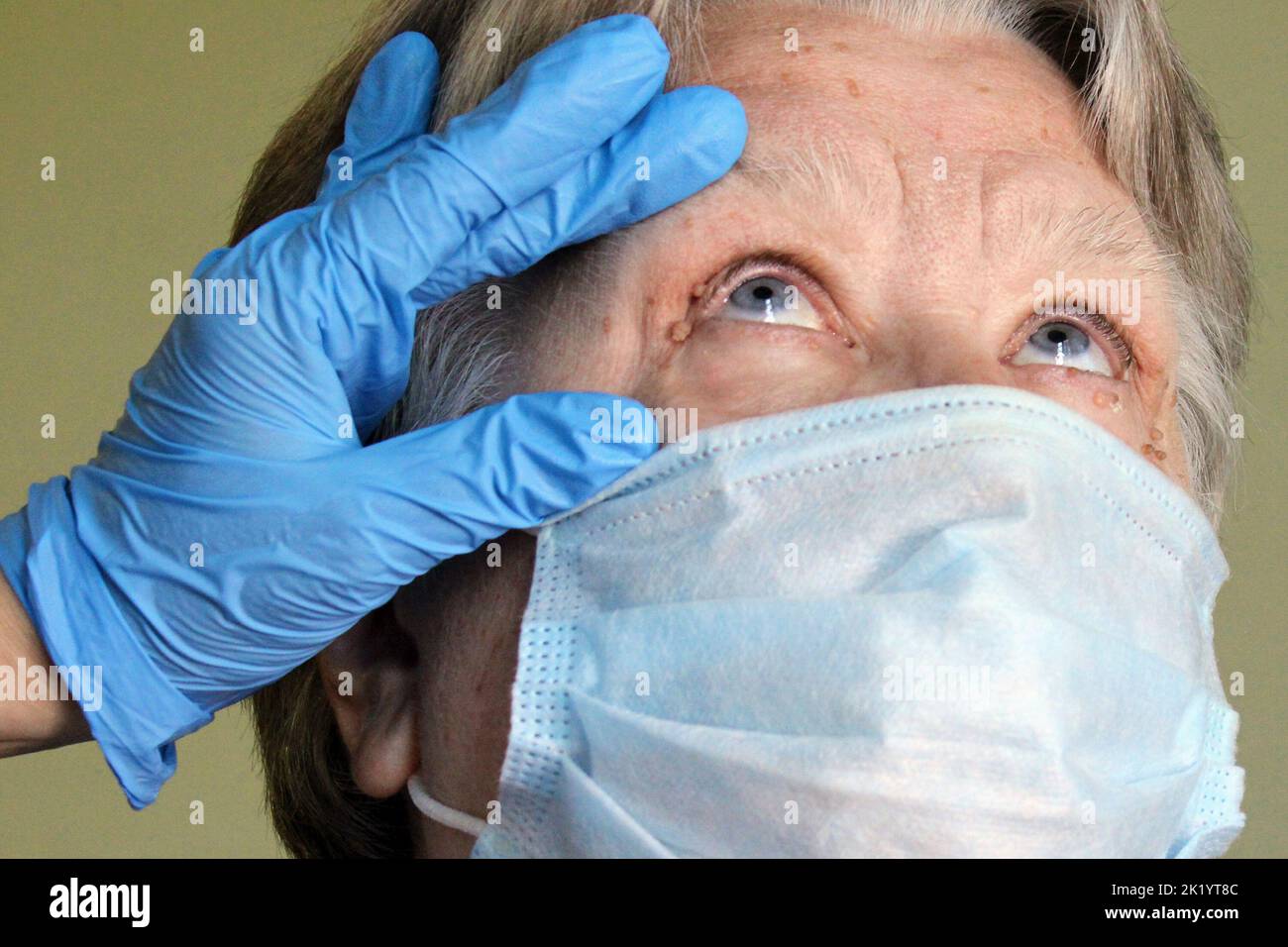 The doctor examines the eyes of an elderly woman with papillomas. At ...