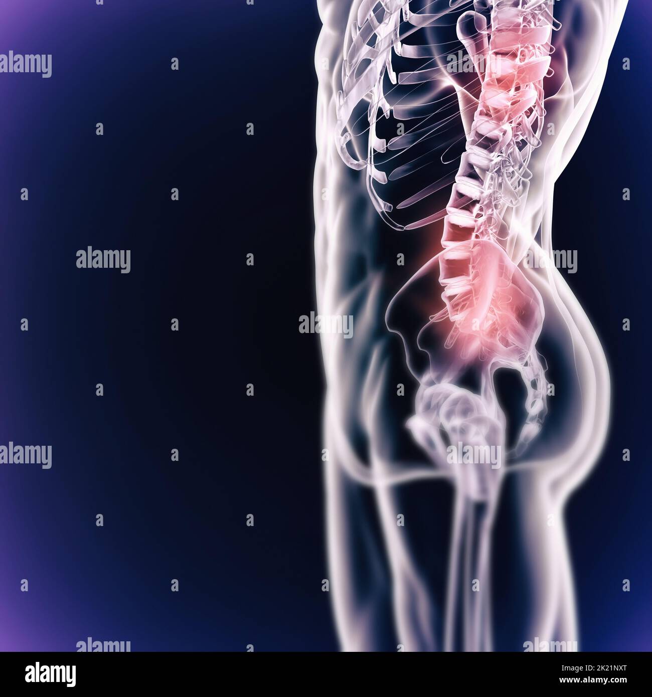 When inflammation strikes. A cgi view of an inflamed joint isolated on ...