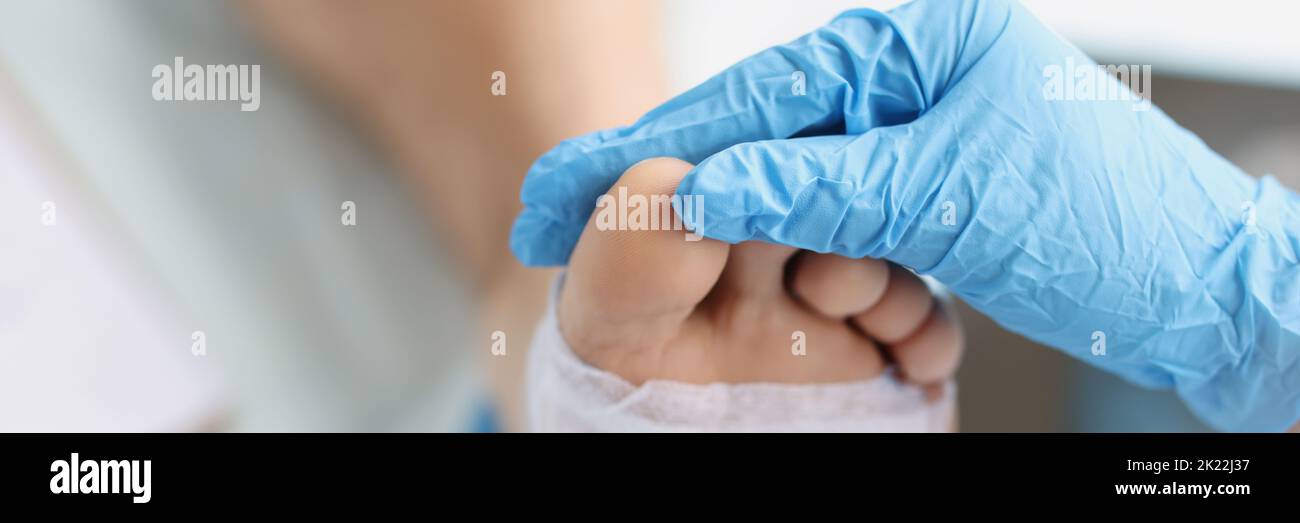 Doctor conducts medical examination of foot with patch Stock Photo - Alamy