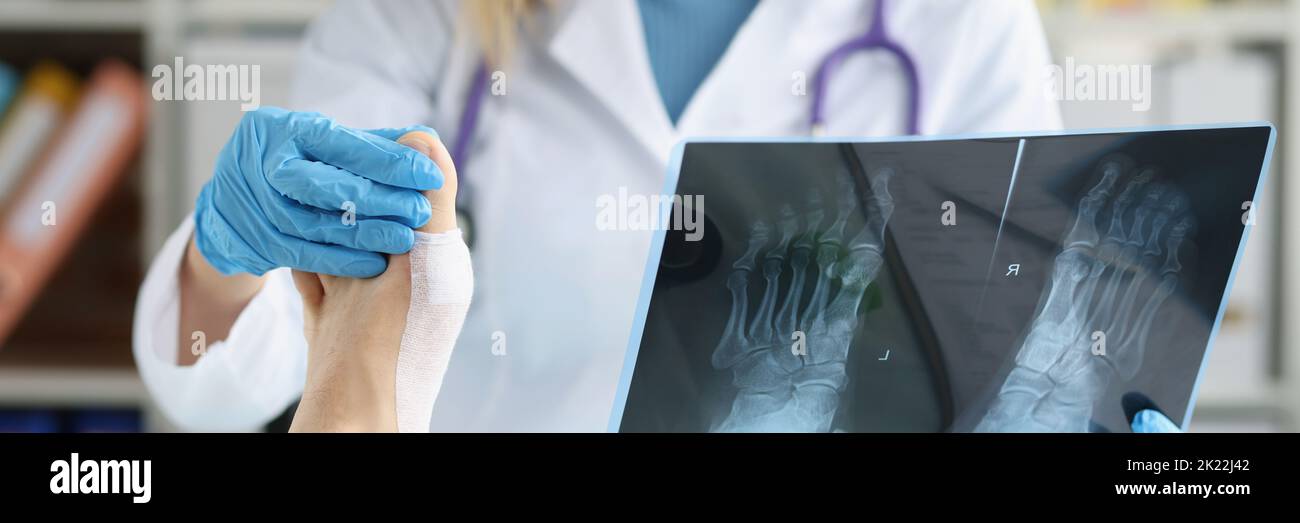 Patient with leg injury at doctor appointment closeup Stock Photo - Alamy