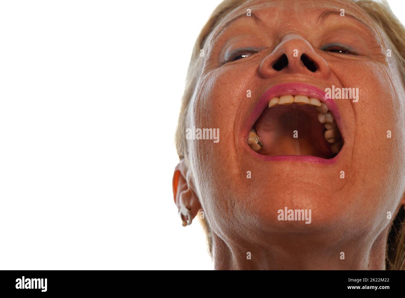 Elderly female patient opens her mouth and shows her teeth. Dental ...