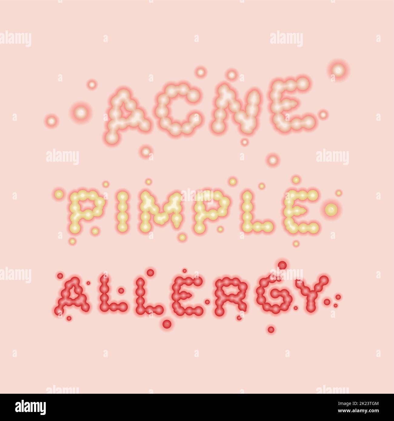 Acne, Allergy and Pimple lettering set. Pimple lettersTypography. whelk ...