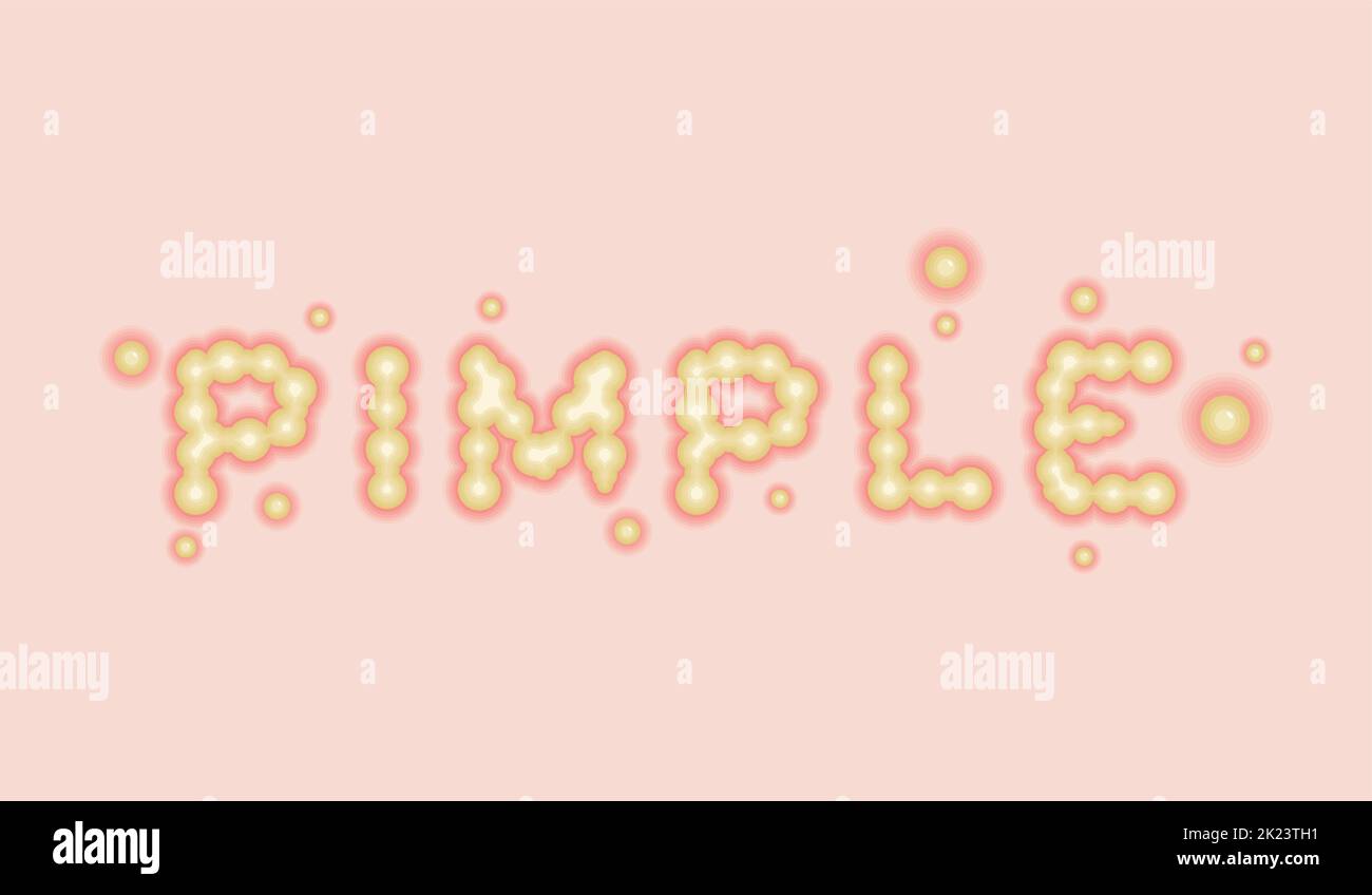Pimple lettering. Acne lettersTypography. whelk typography Vector ...
