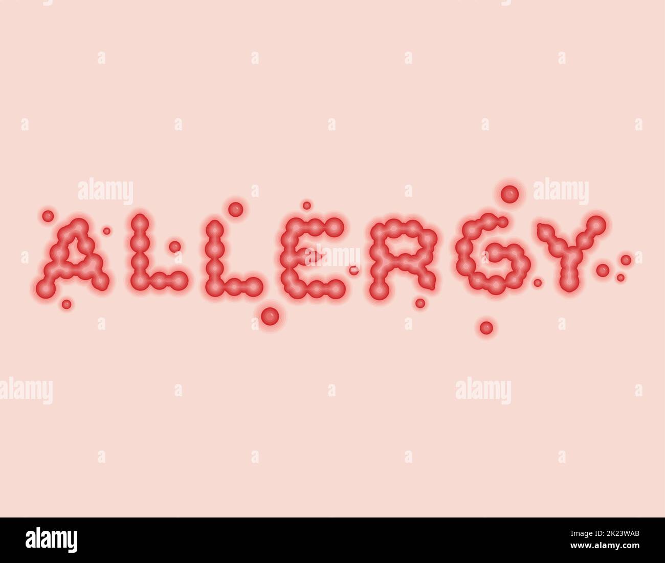 Allergy lettering. Pimple lettersTypography. Acnea whelk typography ...