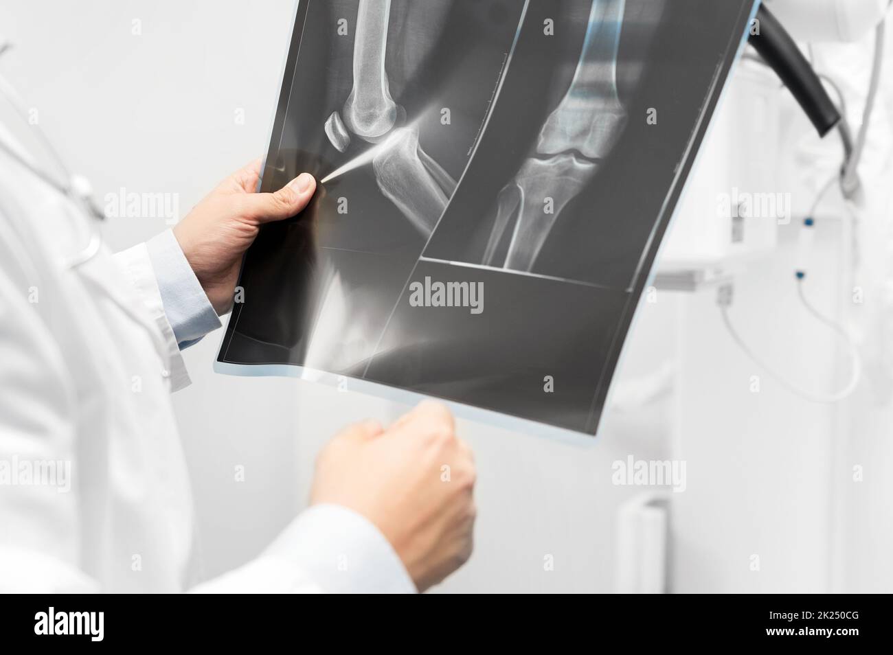 Doctor examine a film x-ray of a patient at radiology room. High ...