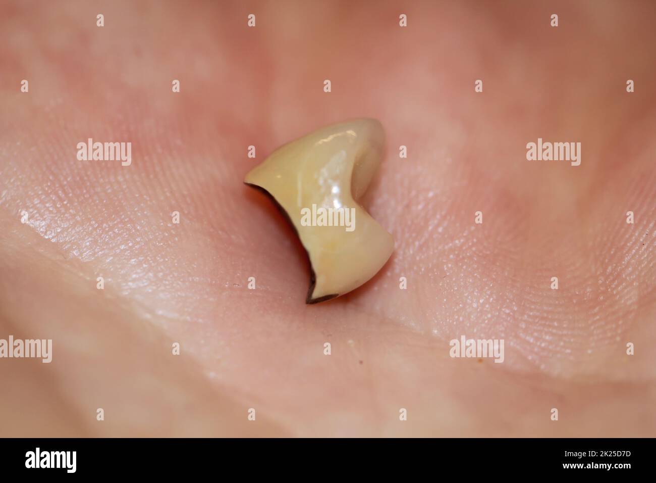 Beauty of the tooth hi-res stock photography and images - Alamy