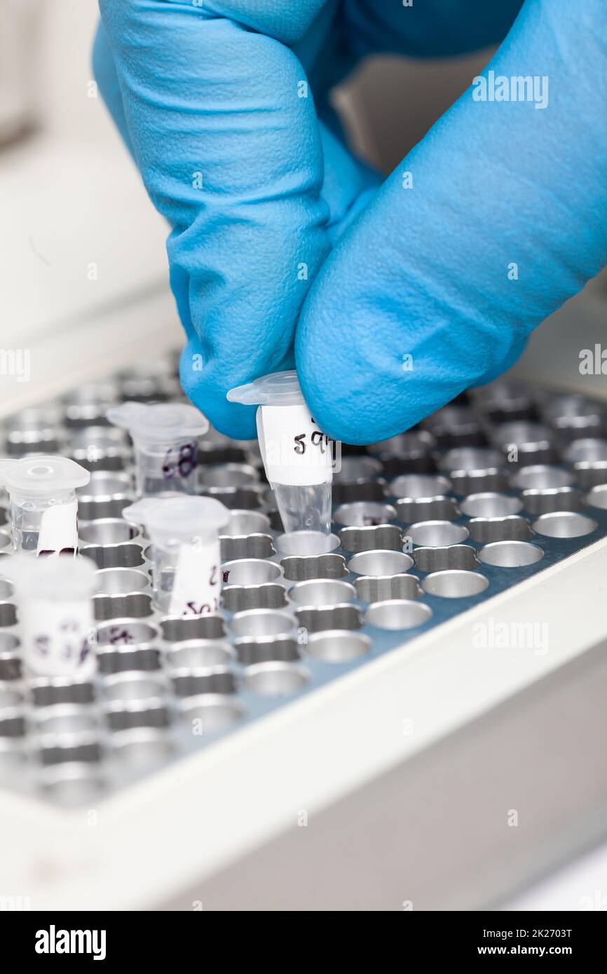 Closeup of a scientist hand while working at the laboratory with a ...