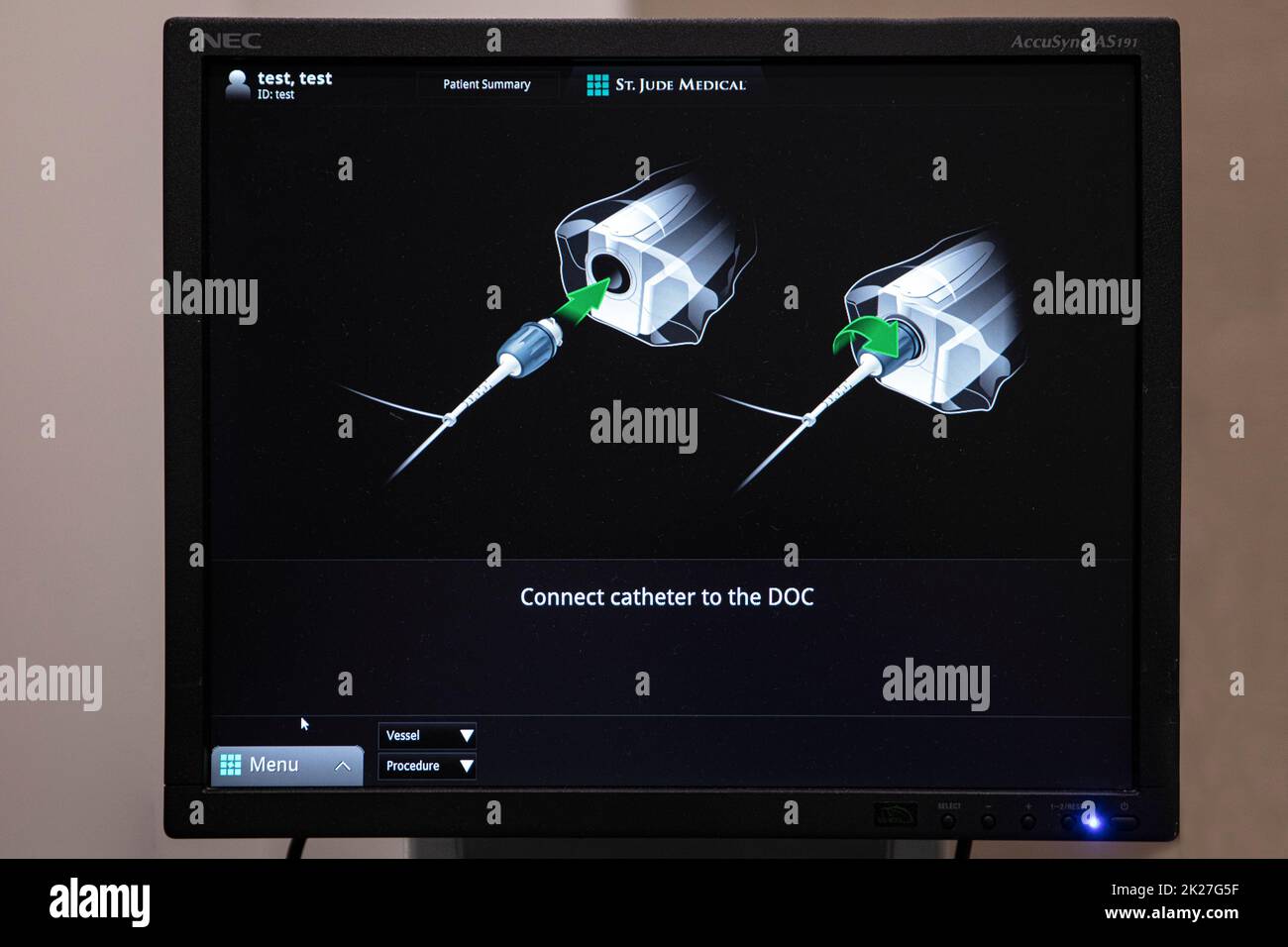 Istanbul, Turkey - September 20, 2022 ; Optical coherence tomography ...