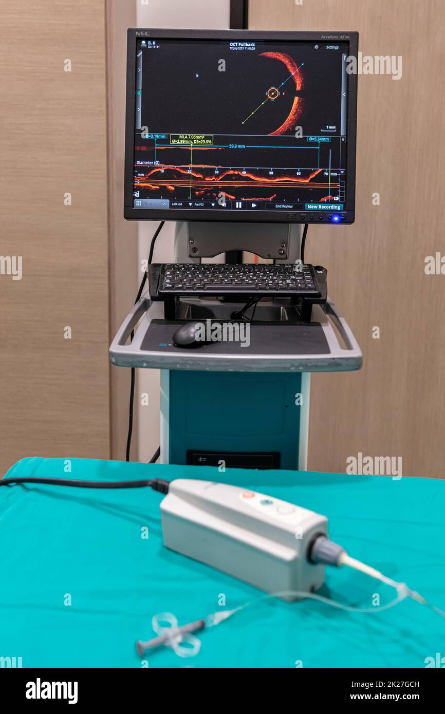 Istanbul, Turkey - September 20, 2022 ; Optical coherence tomography ...