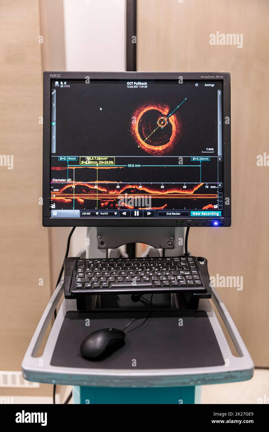 Istanbul, Turkey - September 20, 2022 ; Optical coherence tomography ...