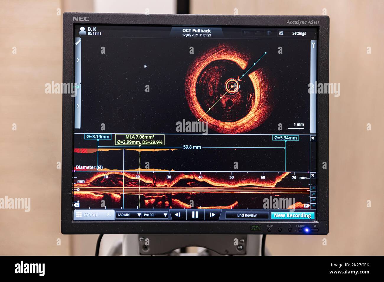 Istanbul, Turkey - September 20, 2022 ; Optical coherence tomography ...