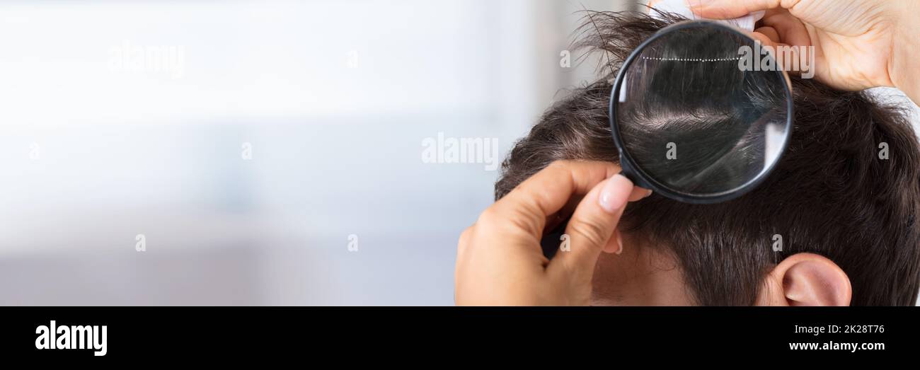 Dermatologist Doctor Checking Head Hair Lice And Hairloss Stock Photo ...