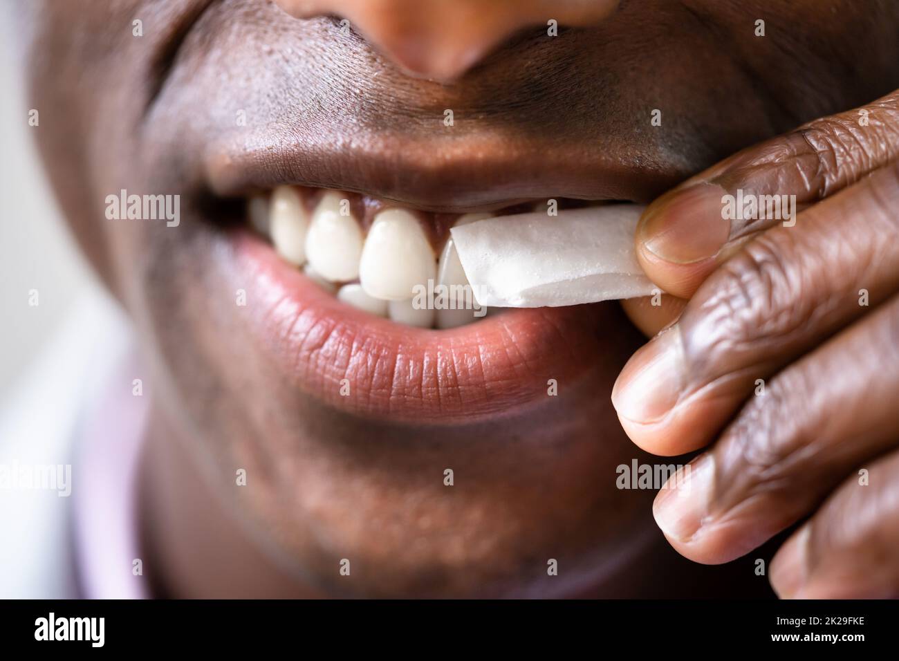 Lip cancer hi-res stock photography and images - Alamy
