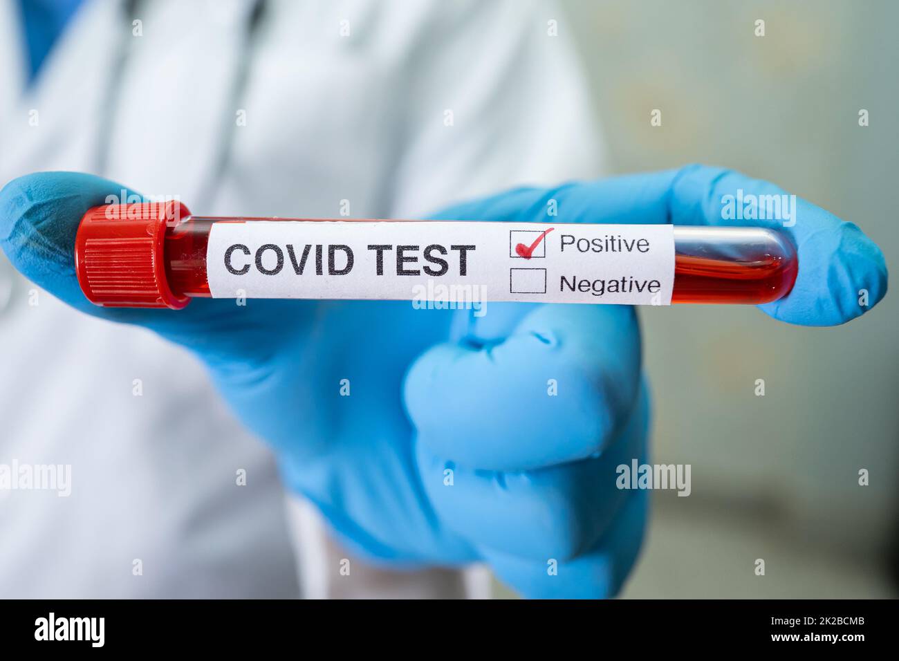 Positive blood infection sample in test tube for covid-19 coronavirus ...