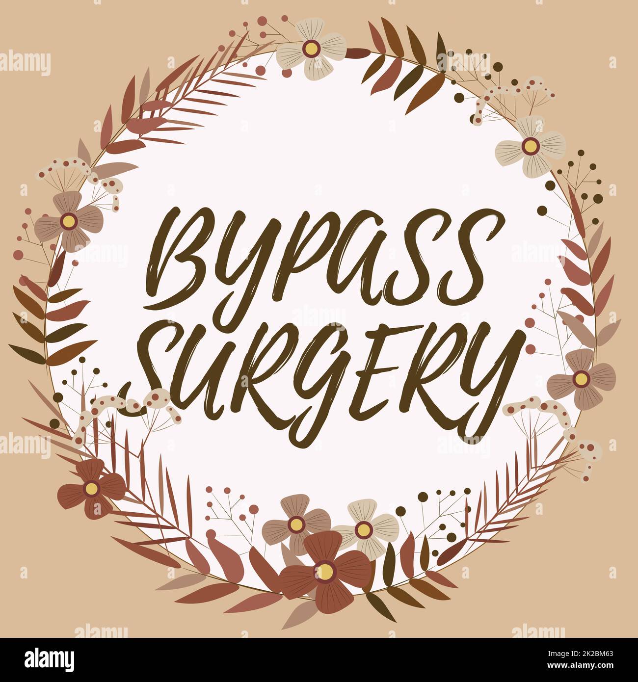 Text sign showing Bypass Surgery. Word Written on type of surgery that ...