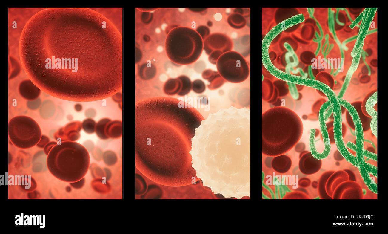 The infection is spreading. A combined image of various micro organisms ...