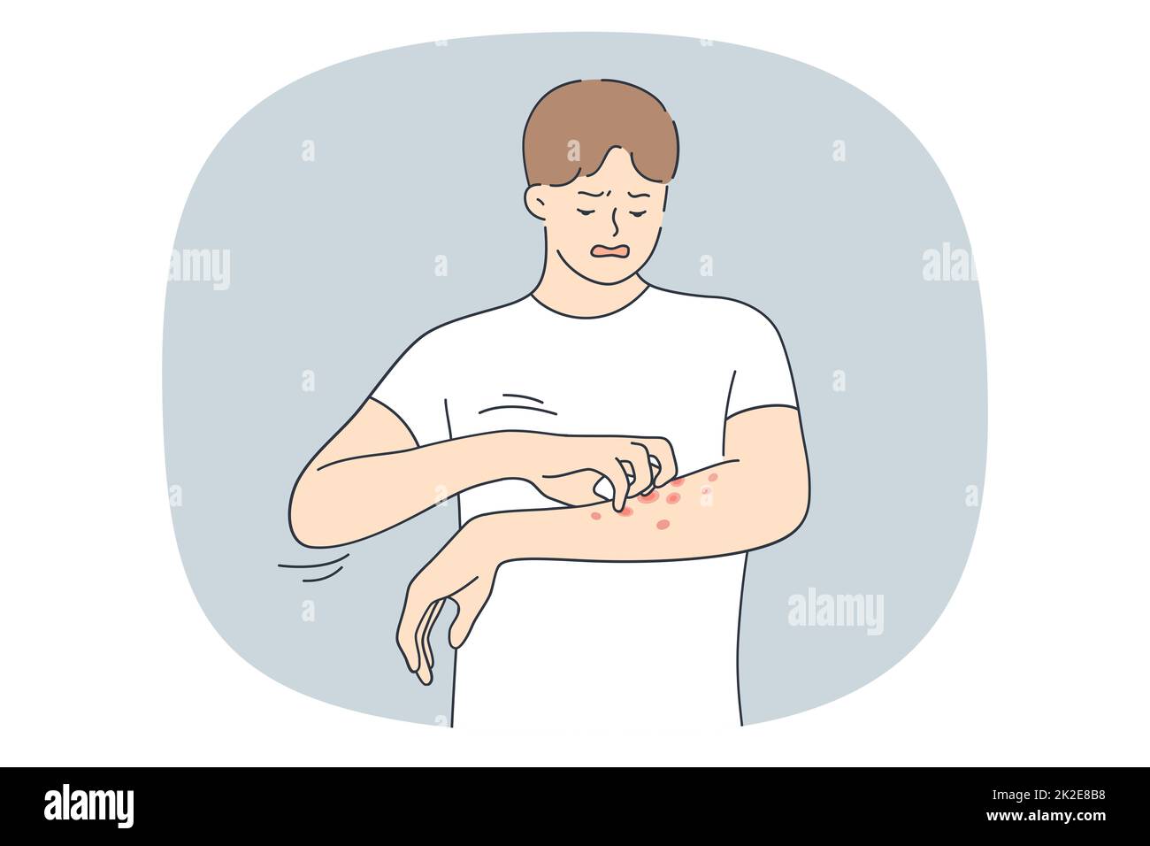 Scabies hand drawing hi-res stock photography and images - Alamy