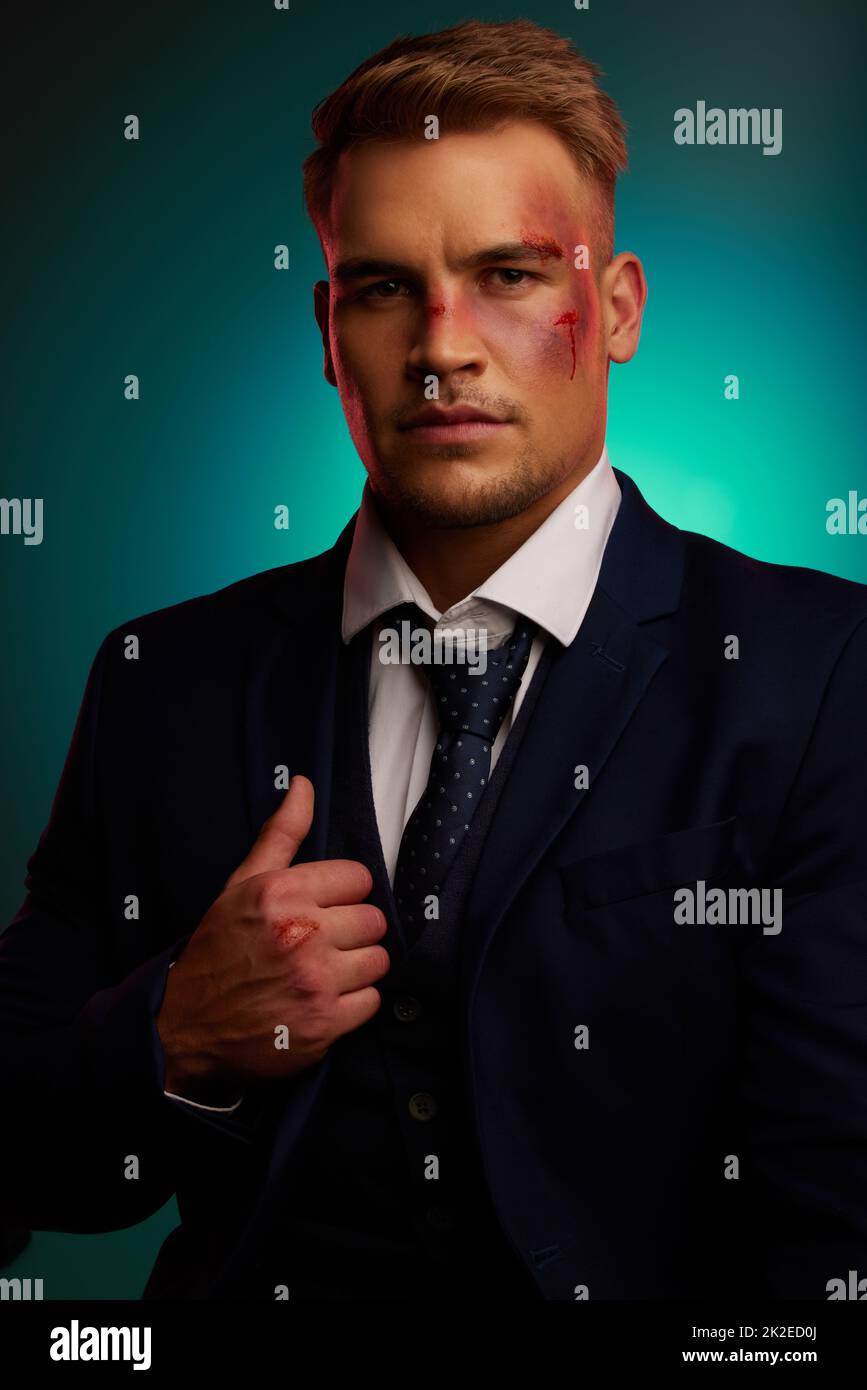 Bruised face hi-res stock photography and images - Alamy